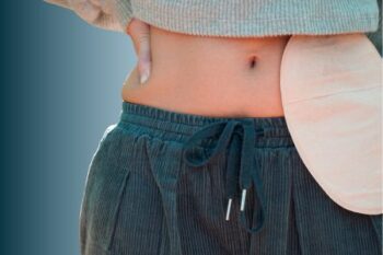 5 Frequently Asked Questions About Living with a Colostomy