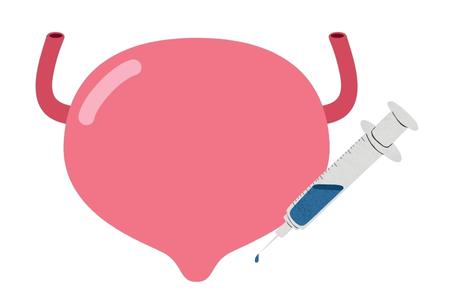 7 Things You Should Know About Botox Bladder Injections